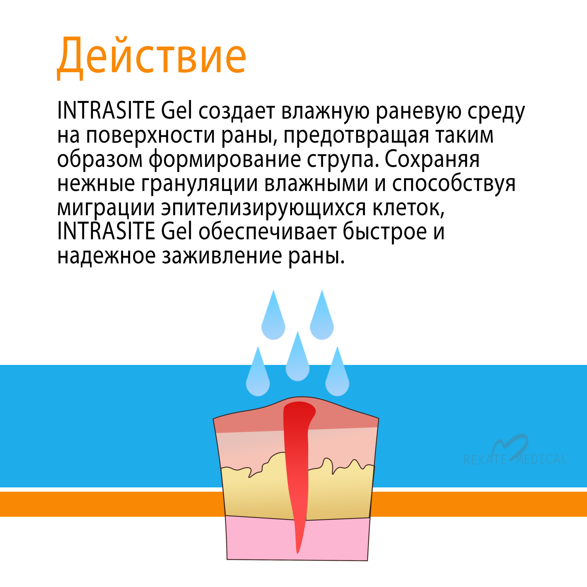 INTRASITE GEL (ИнтраСайт Гель) - Моделируемая гидрогелевая повязка ...