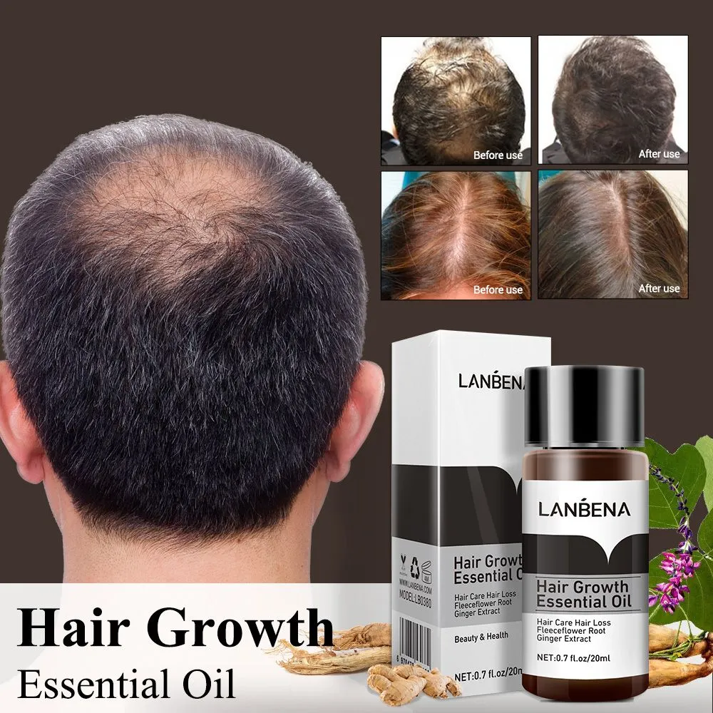 Lanbena Hair Growth Essential Oil 399 Golden Patch
