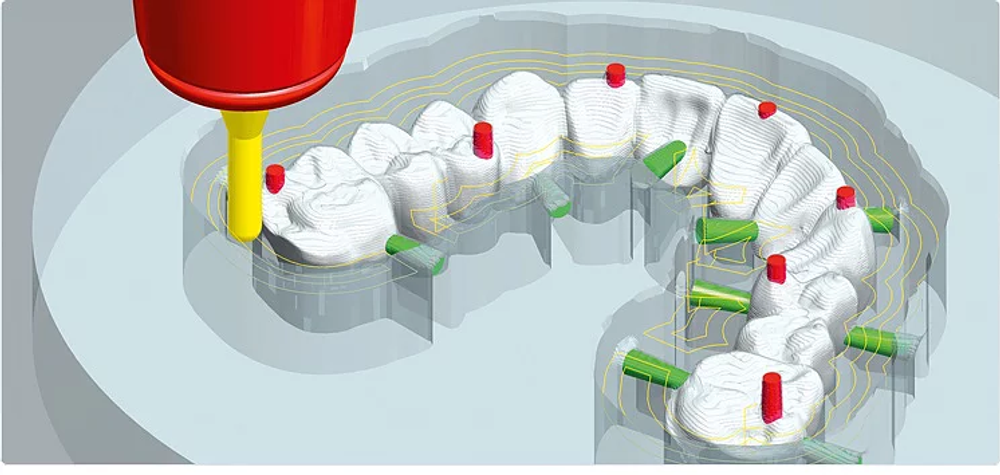 Программа для зуботехнической лаборатории | DentalCADCAM.ru